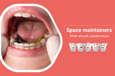 What should a parent know about space maintainers?