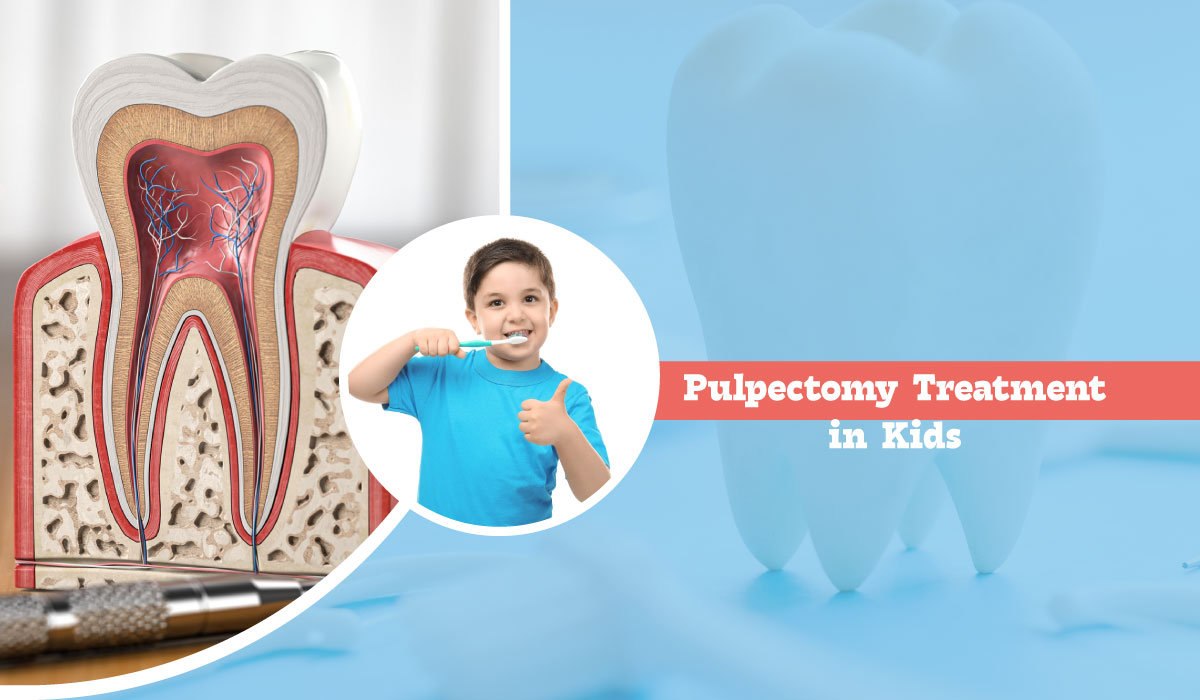 Pulpectomy Treatment in Kids: When and Why It's Needed