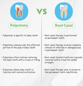What is the Difference Between Pulpotomy vs Root Canal