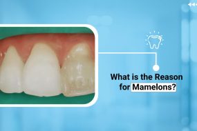 Understanding Mamelons: What They Are & Why They Matter