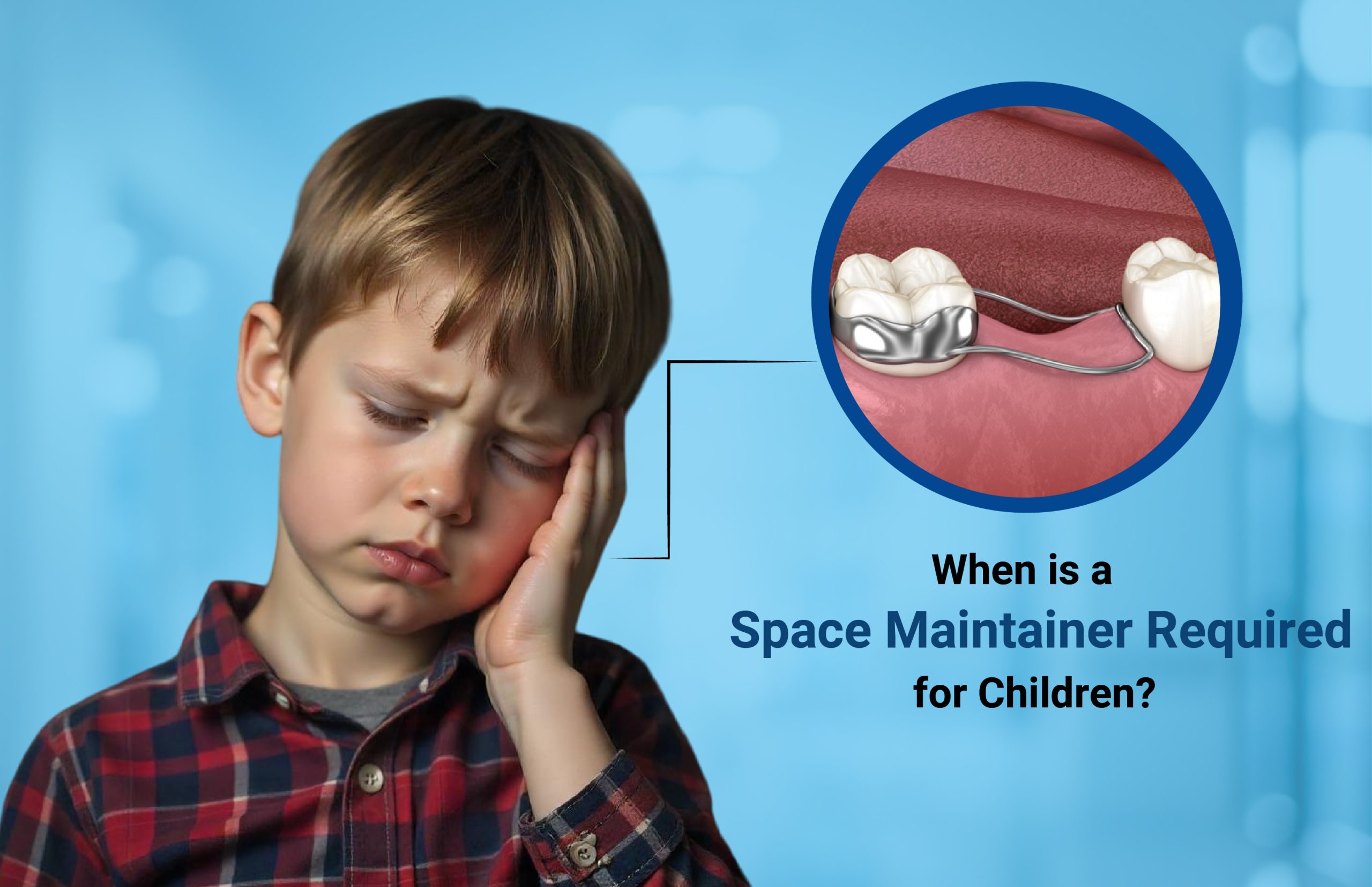 When Are Space Maintainers Needed for Children?